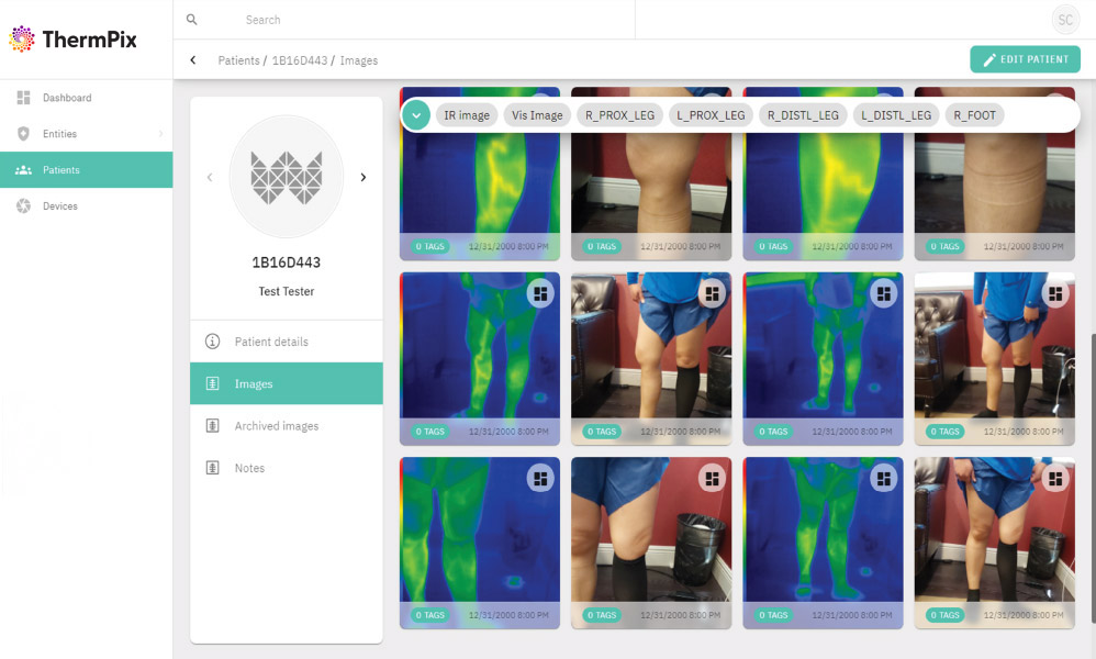 ThermPix® Thermovisual Device - USA Therm